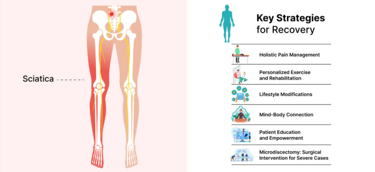 Sciatica Recovery Process - All Injury Rehab
